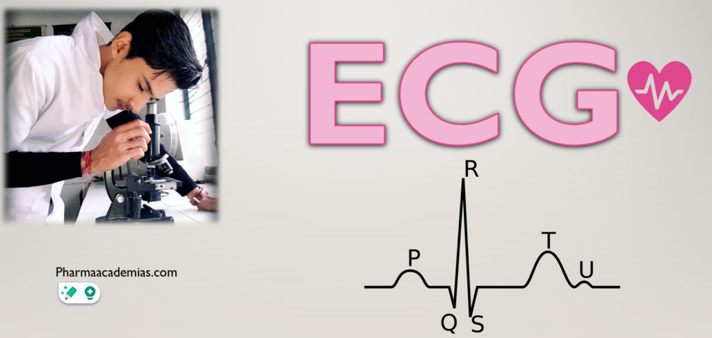 Electrocardiogram (ECG): Definition, Types, Waves and uses ...