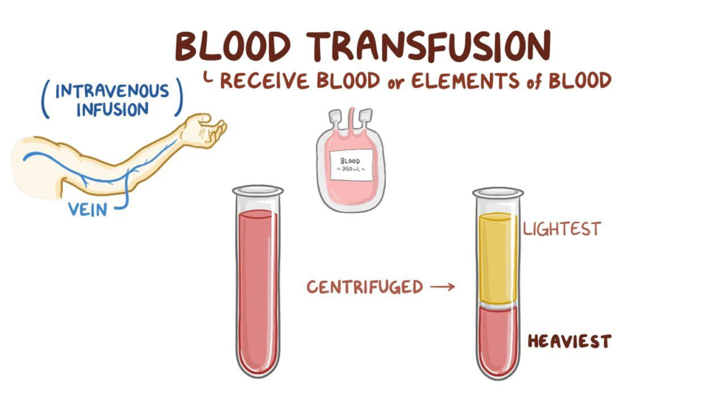 Blood transfusion: Definition, History, Procedure - Pharmaacademias