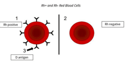 Rh Factor: Genetics, Clinical Importance, and Future Perspectives