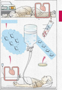 Plasma Volume Expanders - Pharmaacademias